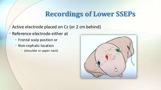 Lower Extremity Somatosensory Evoked Potentials (lower SSEP)
