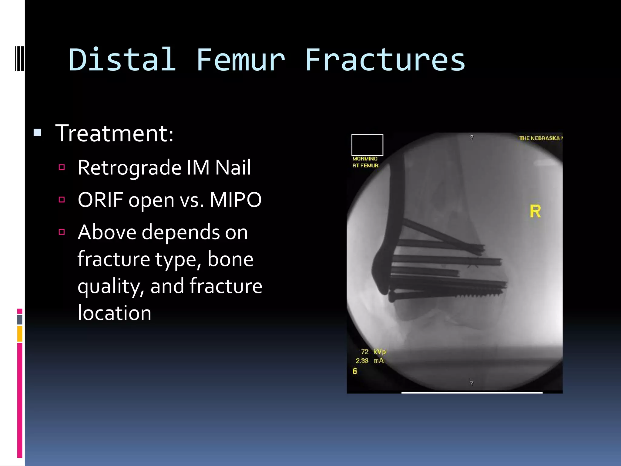 Lower extremity trauma 1 | PPTX