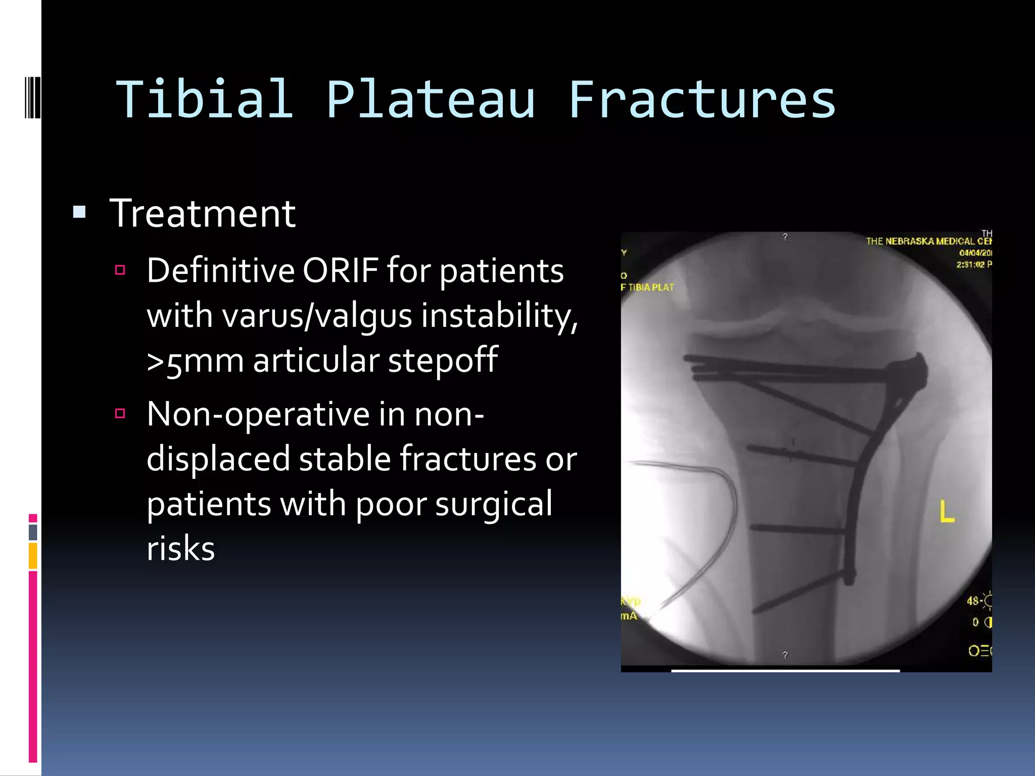 Lower extremity trauma 1 | PPTX