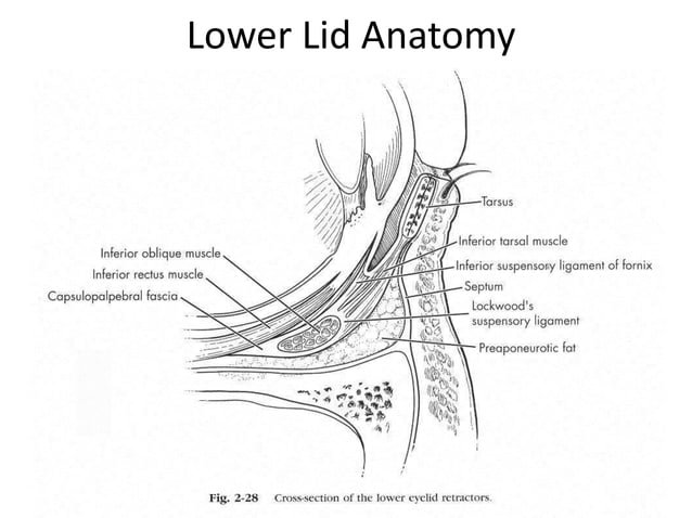 Lower eyelid reconstruction | PPTX