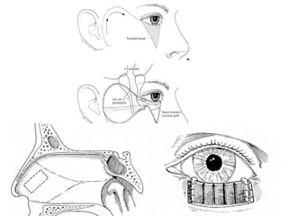 Lower eyelid reconstruction | PPTX