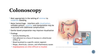 LOWER Gastro Intestinal Bleeding and its managements.pptx