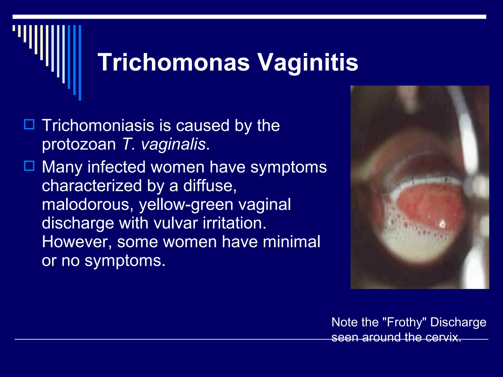 Lower Genital Tract Infection Ppt