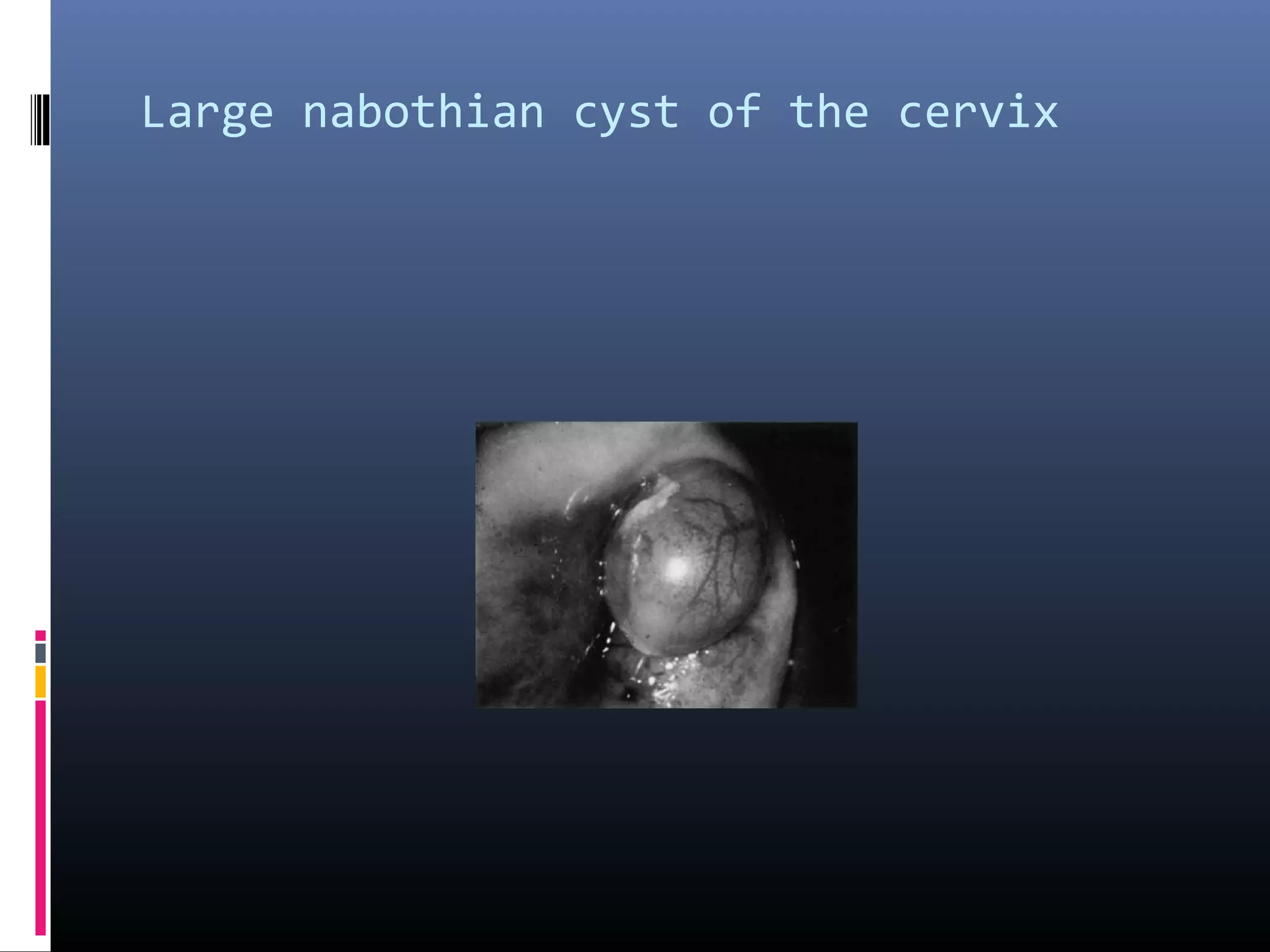 Lower genital tract tumors | PPT