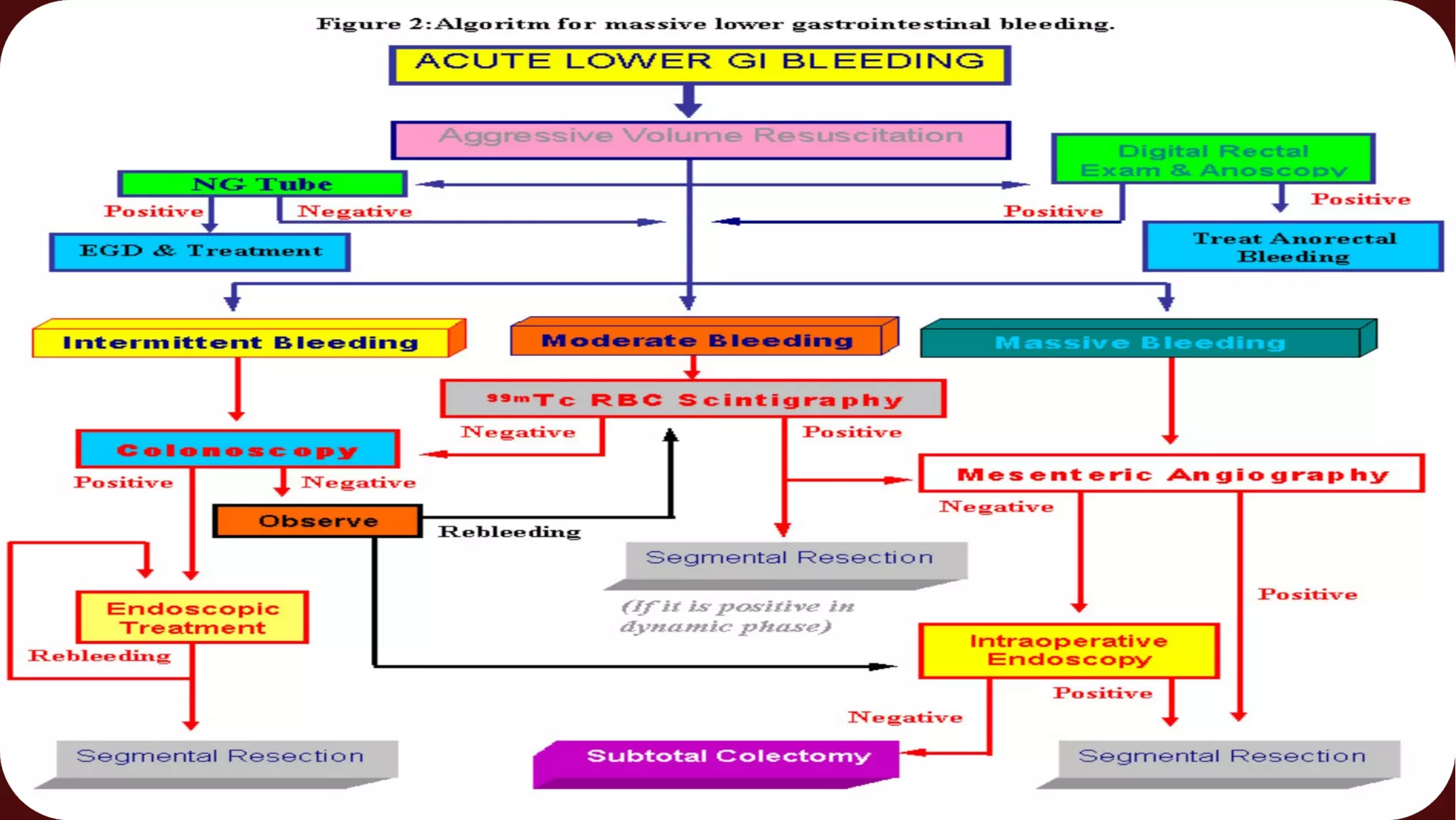 Lower GI - Bleed | PPT