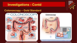 Lower GI - Bleed | PPT