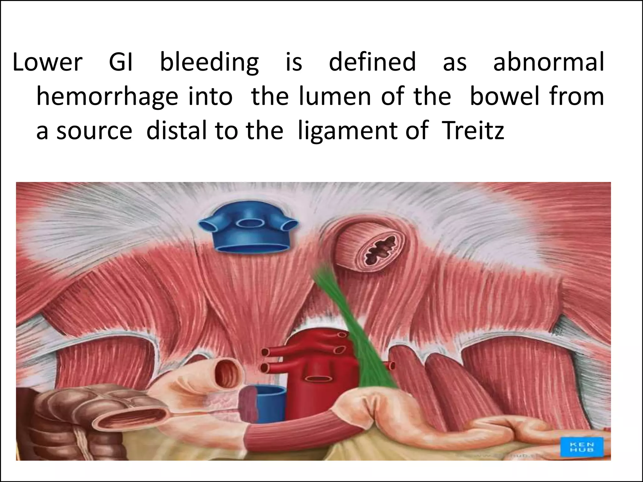 Lower Gastrointestinal Bleed | PPTX