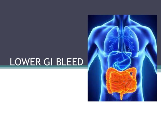 Lower GI bleed.pdf