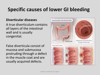 Lower gi bleeding | PPT