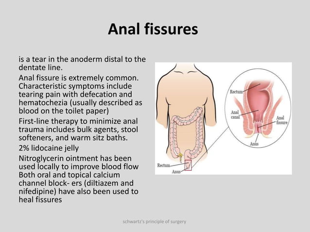 Lower Gi Bleeding Ppt