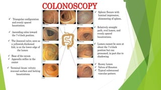 LOWER GI ENDOSCOPY IN SURGICAL PRACTICE.pptx