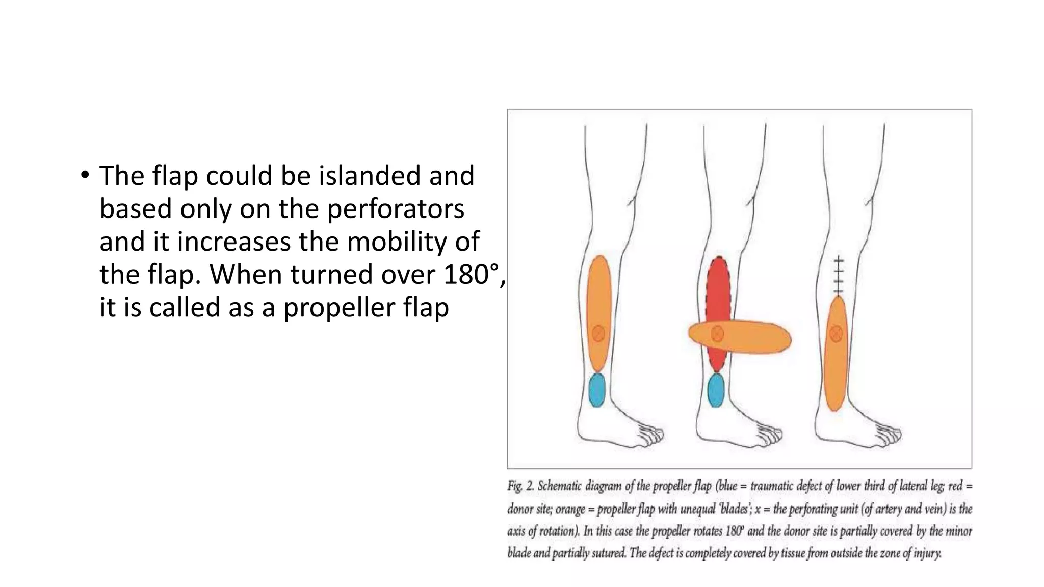 Lower leg defect reconstruction | PPTX