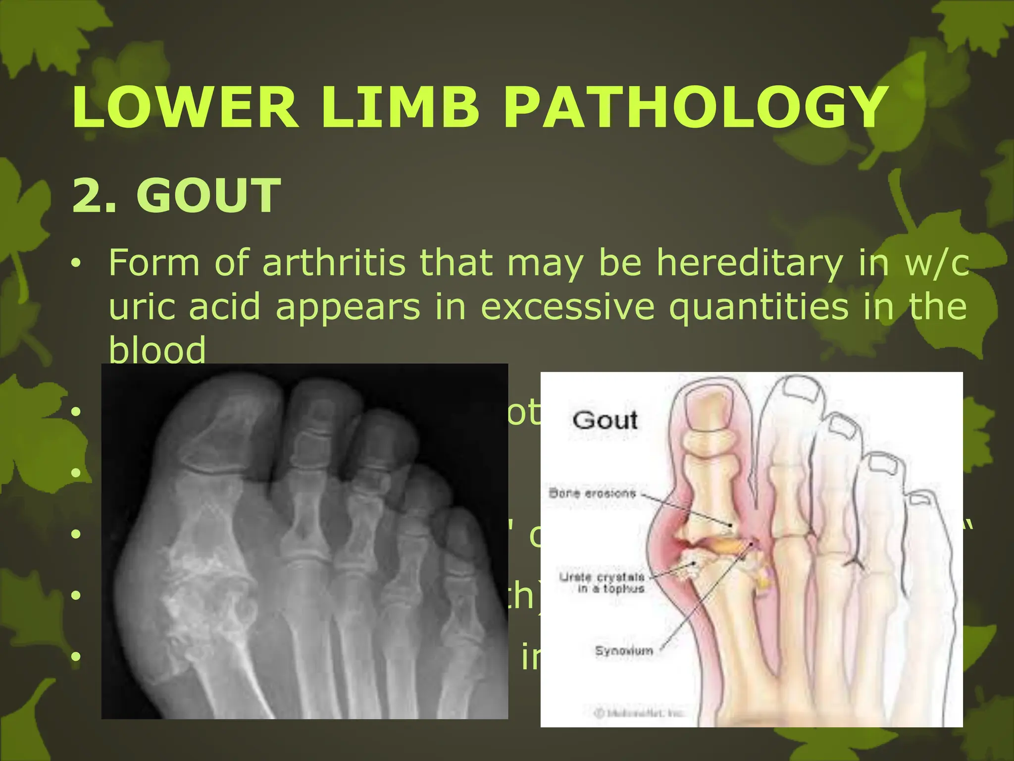 LOWER LIMB-RADPATHOLOGY.pptx