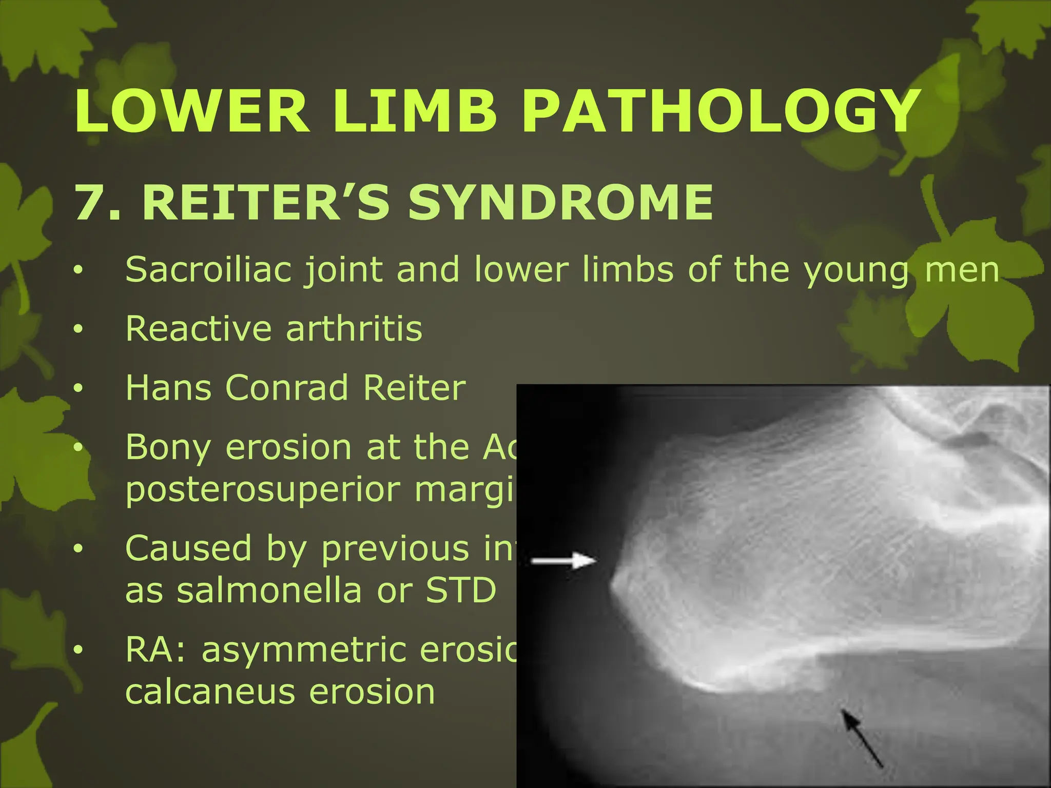 LOWER LIMB-RADPATHOLOGY.pptx
