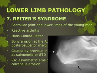 LOWER LIMB-RADPATHOLOGY.pptx