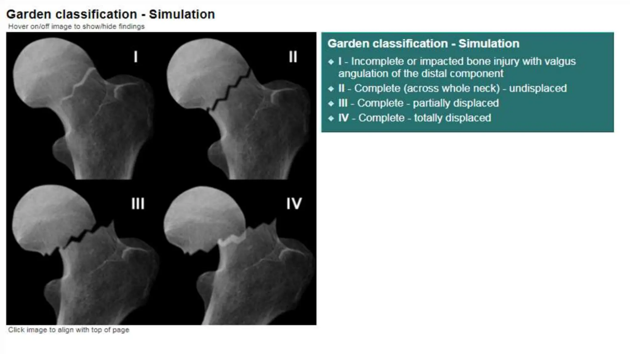 Anatomy and Pathologies Of The Upper limb with special focus on upper ...