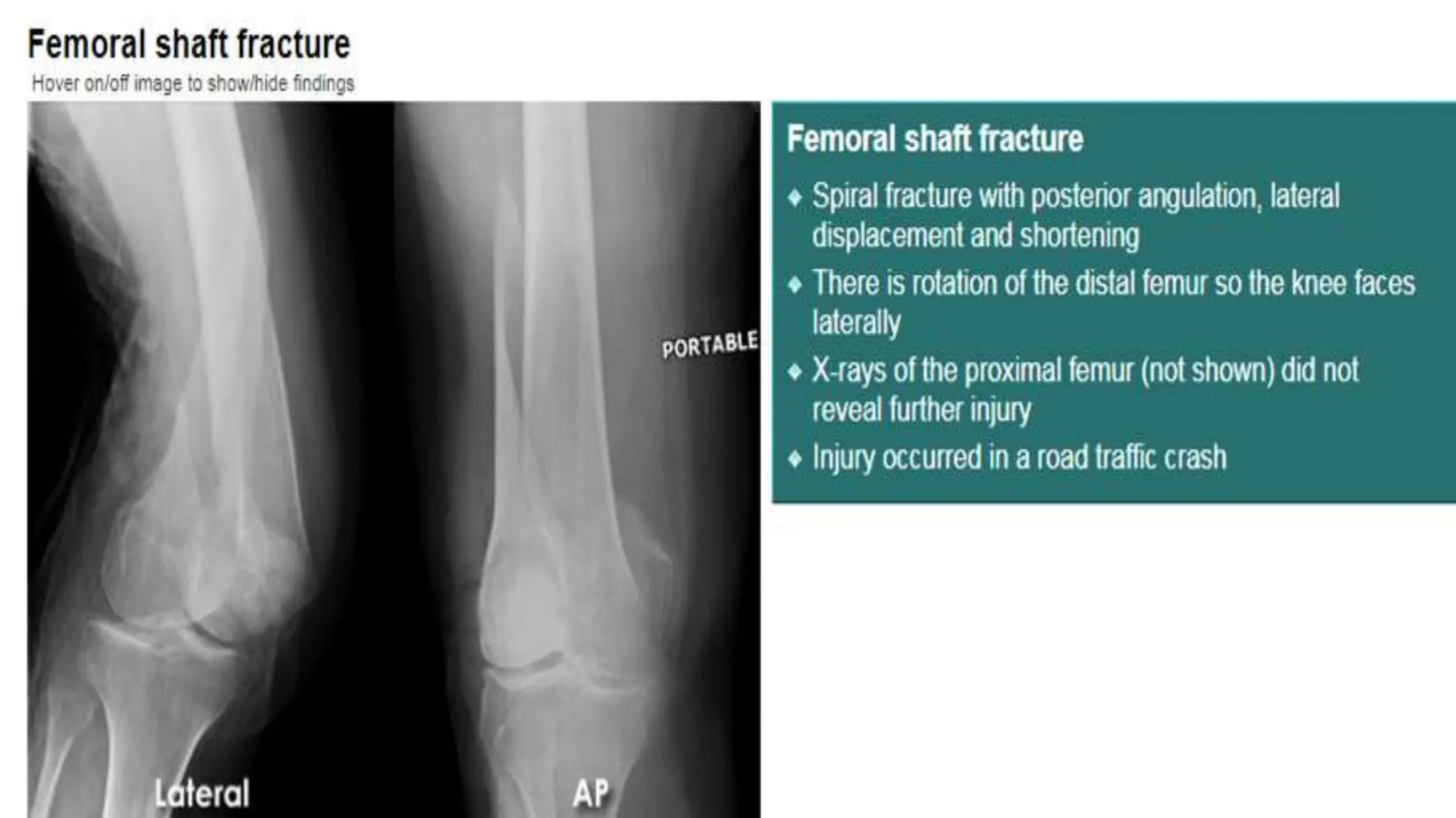 Anatomy and Pathologies Of The Upper limb with special focus on upper ...