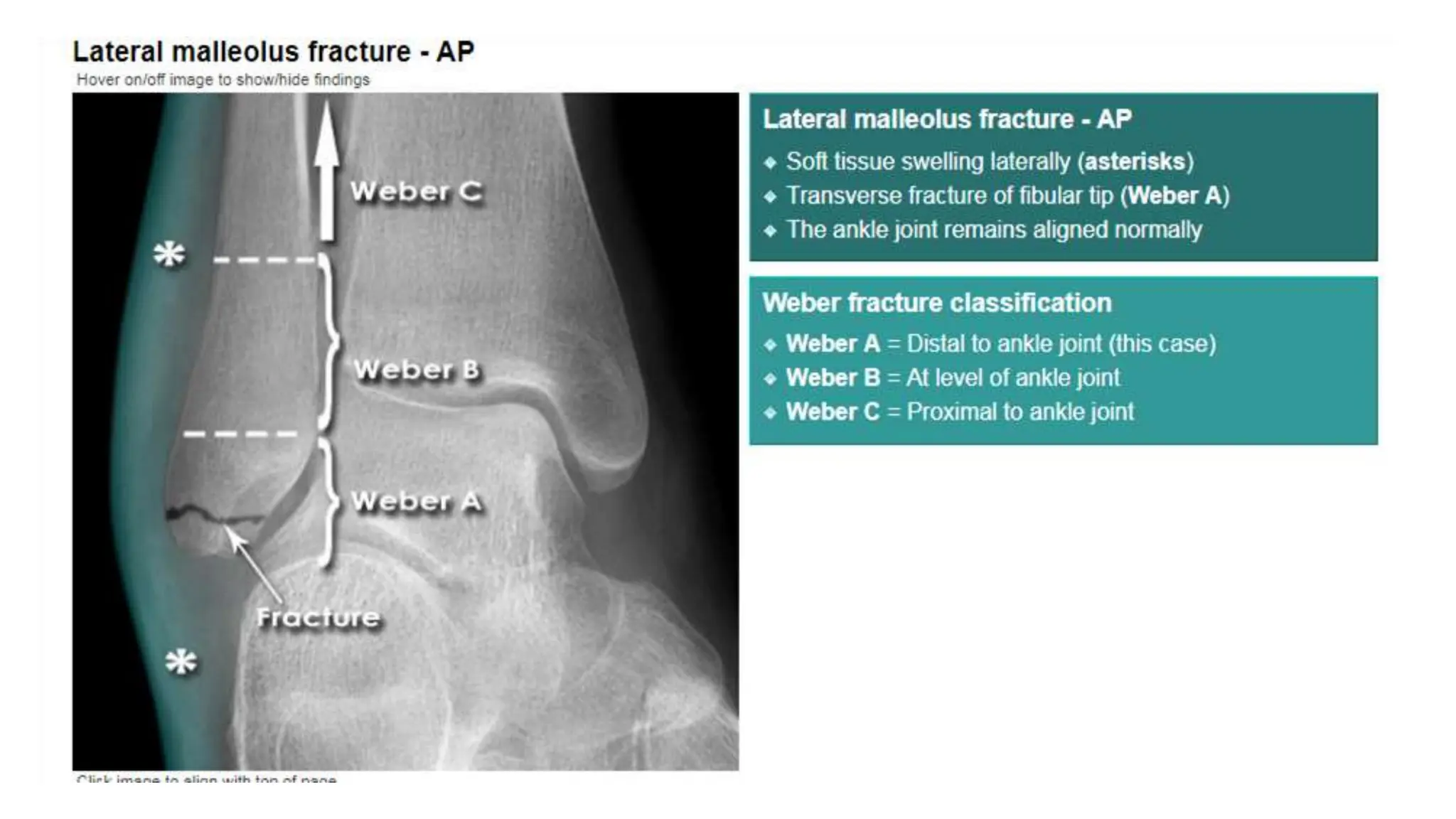 Anatomy and Pathologies Of The Upper limb with special focus on upper ...