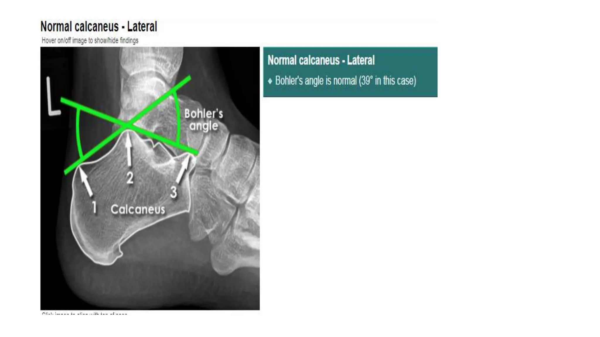 Anatomy and Pathologies Of The Upper limb with special focus on upper ...