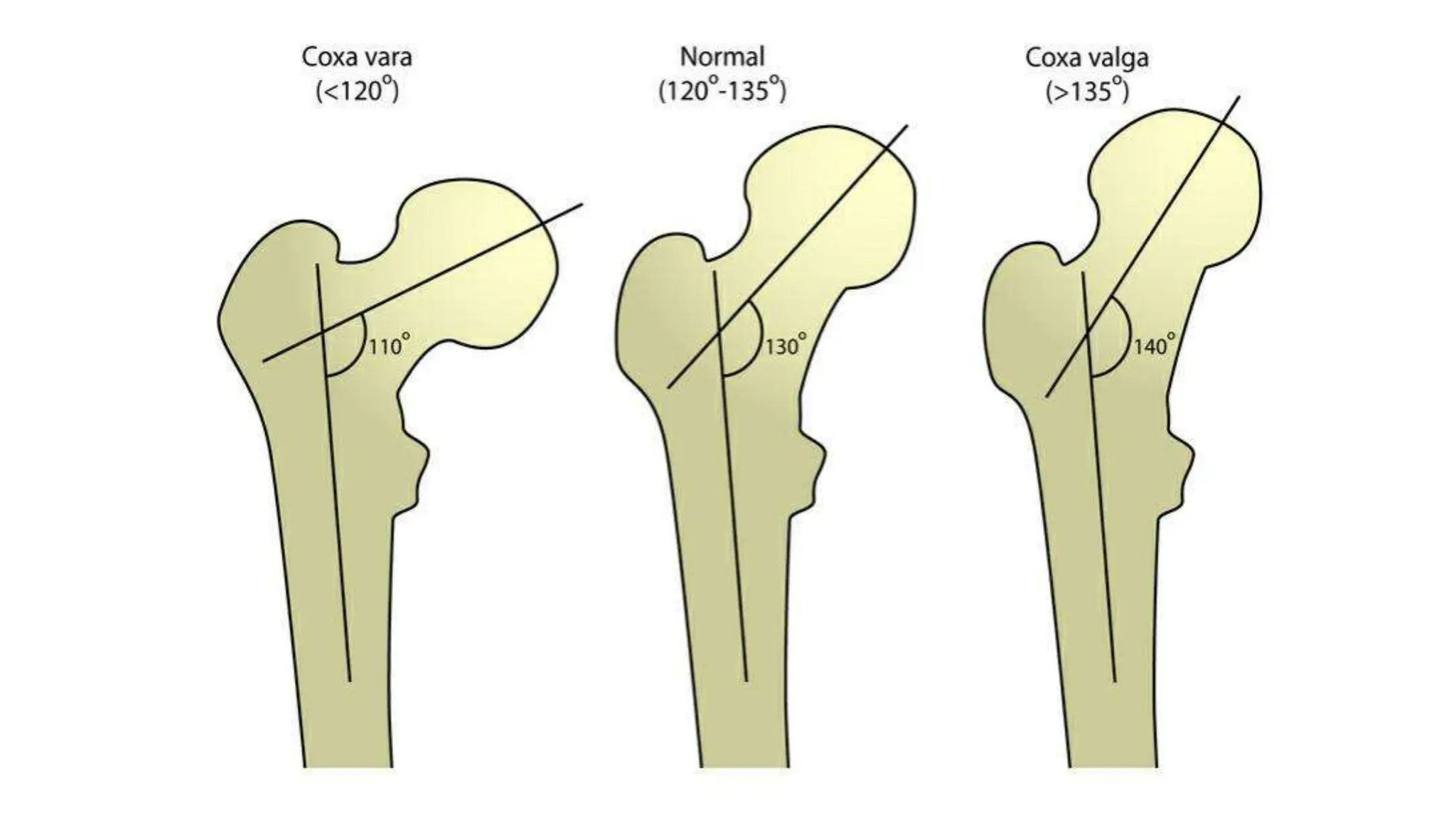 Anatomy and Pathologies Of The Upper limb with special focus on upper ...