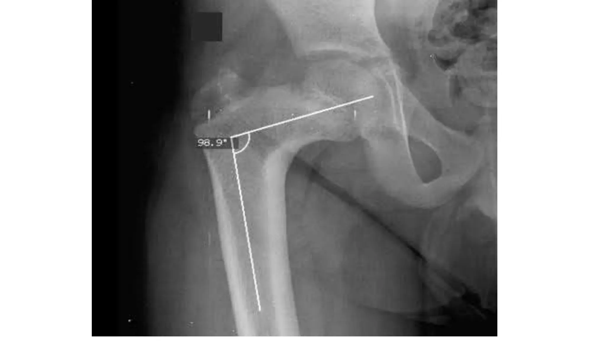 Anatomy and Pathologies Of The Upper limb with special focus on upper ...