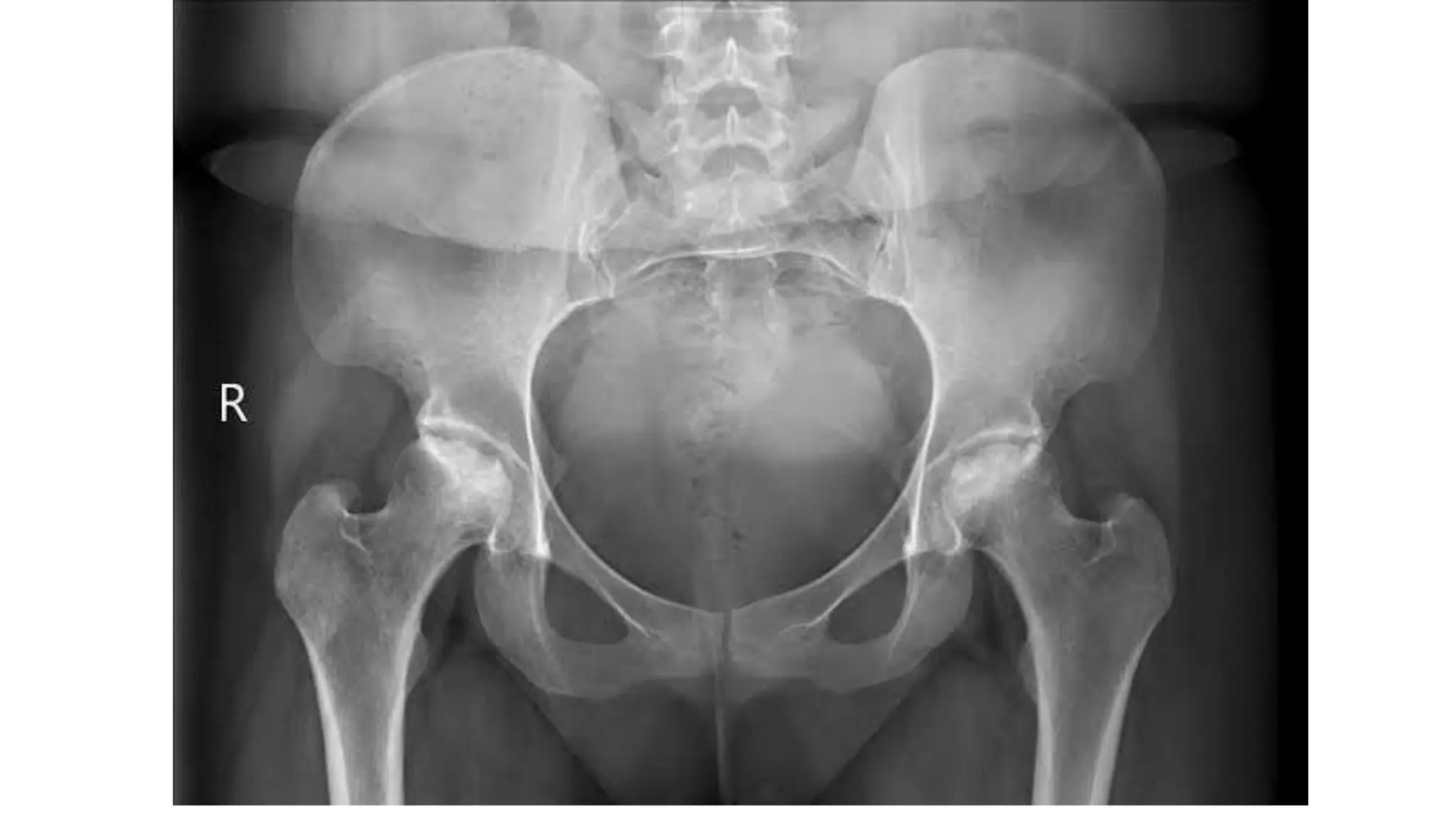 Anatomy and Pathologies Of The Upper limb with special focus on upper ...