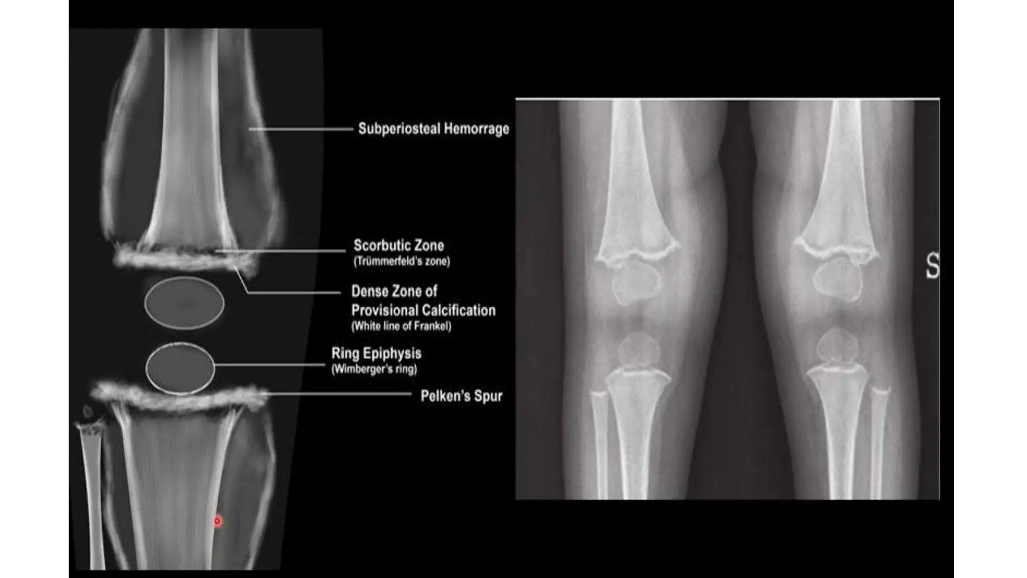 Anatomy and Pathologies Of The Upper limb with special focus on upper ...
