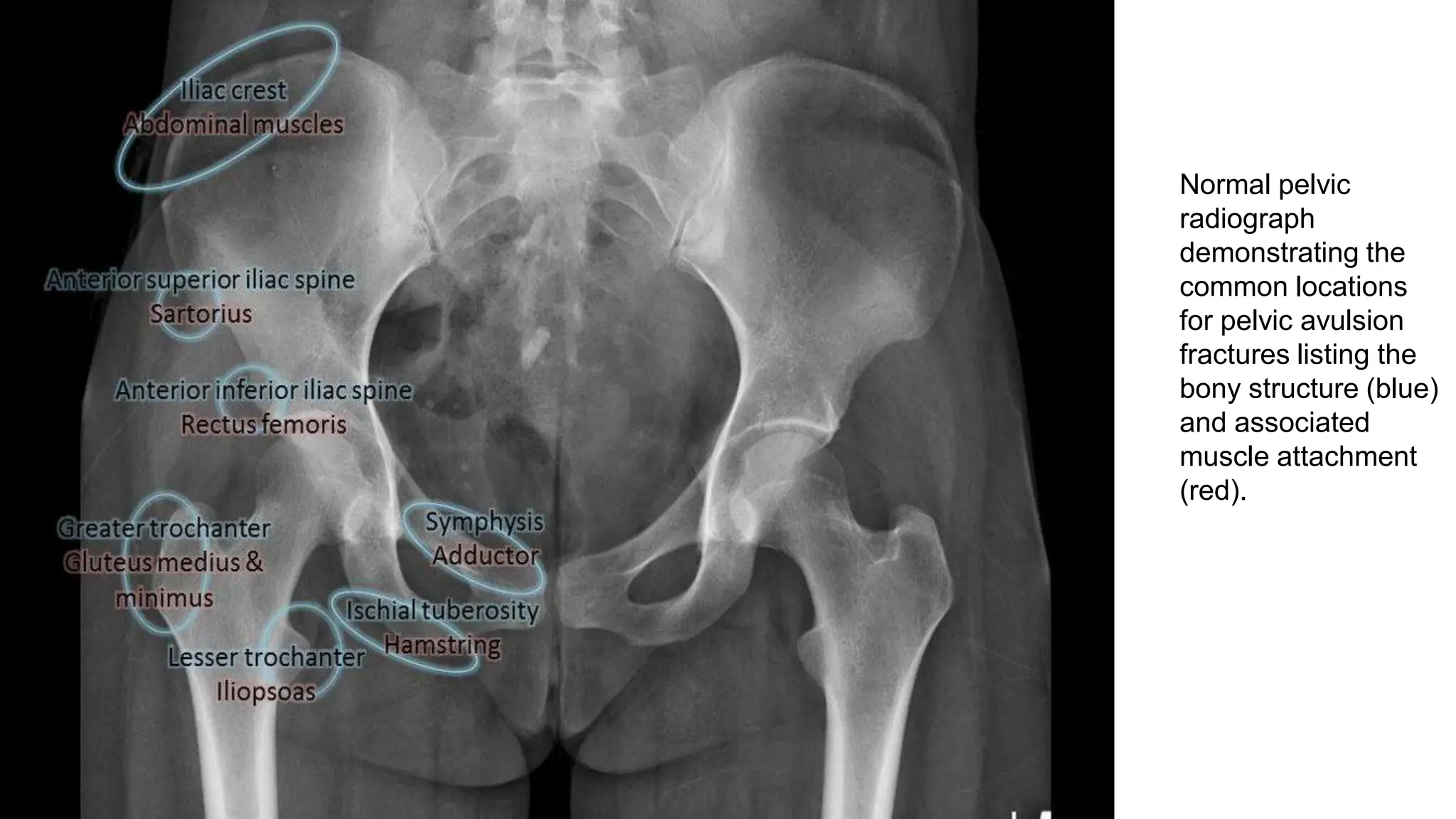 Anatomy and Pathologies Of The Upper limb with special focus on upper ...
