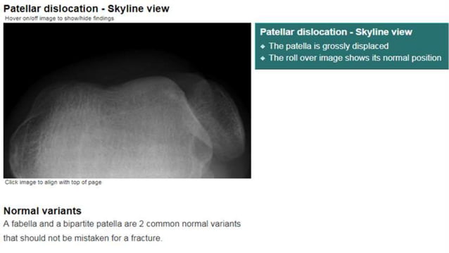 Anatomy and Pathologies Of The Upper limb with special focus on upper ...