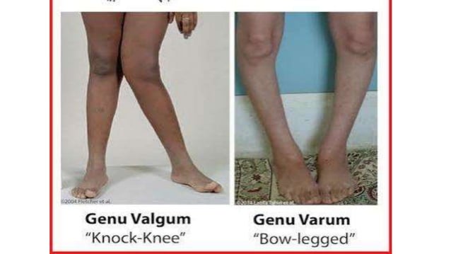 Anatomy and Pathologies Of The Upper limb with special focus on upper ...