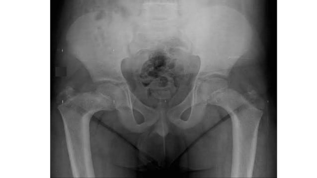 Anatomy and Pathologies Of The Upper limb with special focus on upper ...