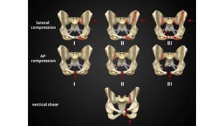 Anatomy and Pathologies Of The Upper limb with special focus on upper ...