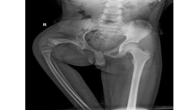 Anatomy and Pathologies Of The Upper limb with special focus on upper ...