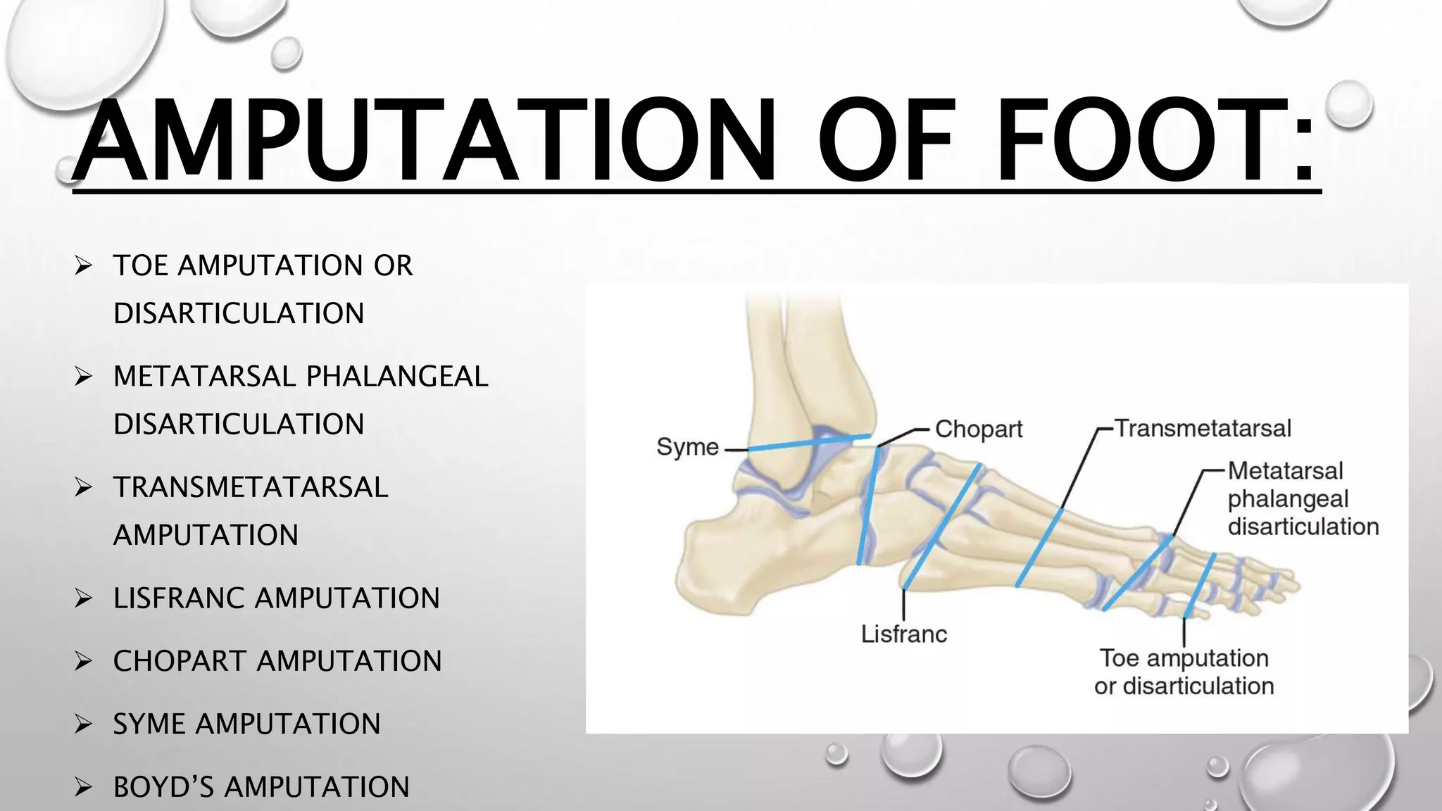 Lower limb amputation | PPTX