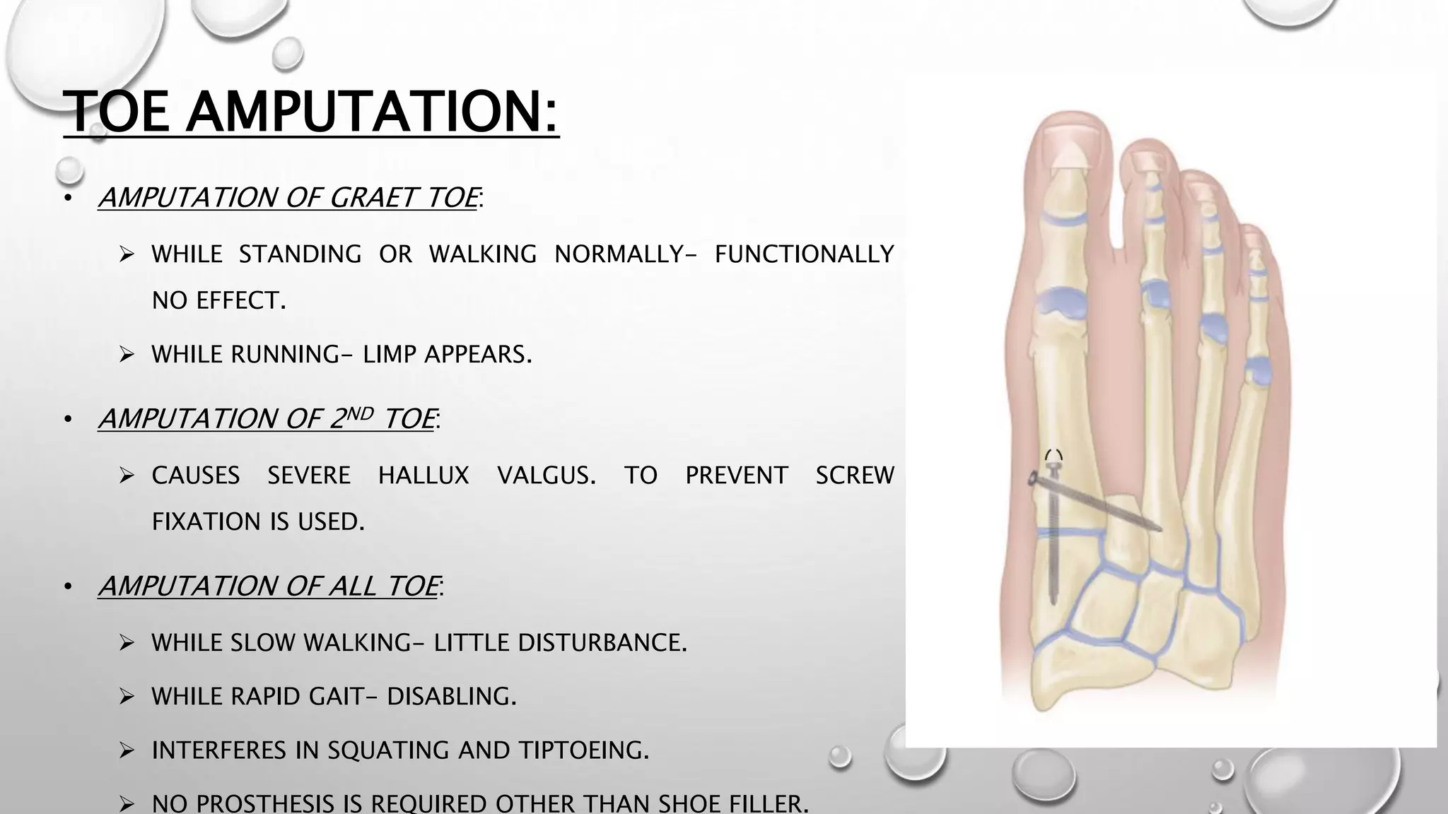 Lower limb amputation | PPTX