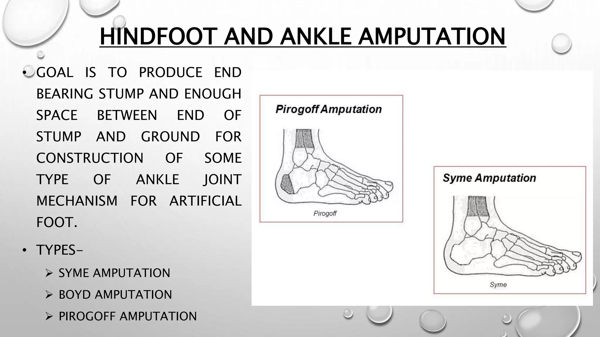 Lower limb amputation | PPTX