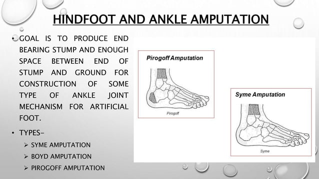 Lower limb amputation | PPTX