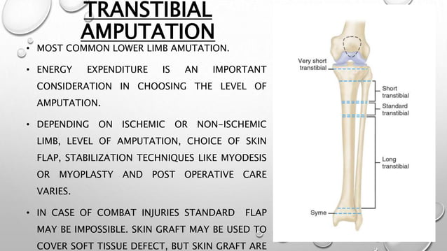Lower limb amputation | PPTX