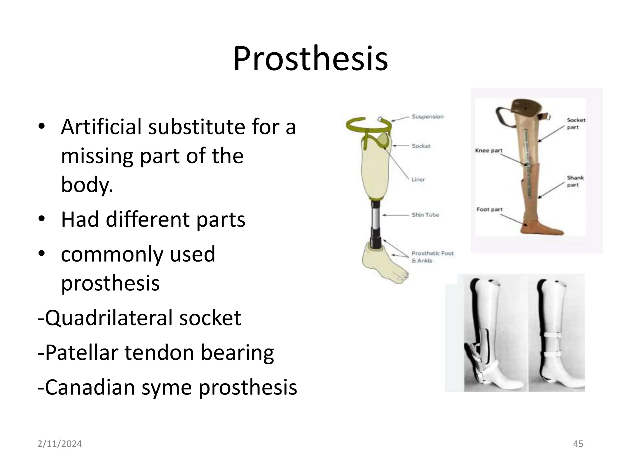 Lower limb Amputation.pptx
