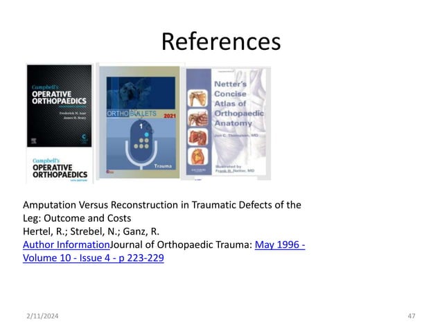 Lower Limb Amputation Pptx Injuries Diseases And Conditions