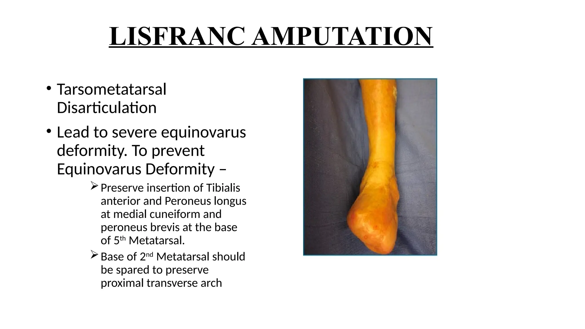 LOWER LIMB AMPUTATION SO much for [1].pptx