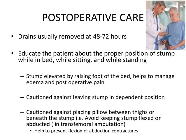 Lower Limb Amputations (Part I)