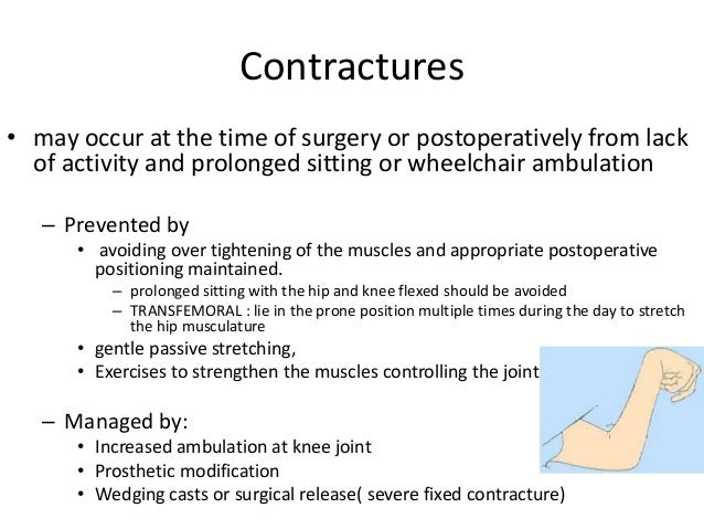 Lower Limb Amputations (Part I)