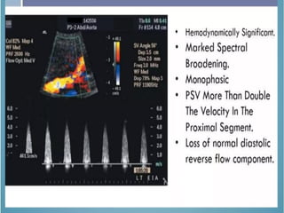 LOWER LIMB ARTERIAL DOPPLER STUDY and pathologies.pptx