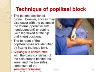 Popliteal Block