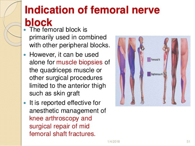Lower limb blocks
