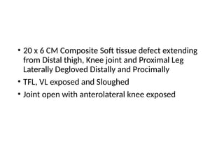 Lower Limb Defect-Thigh,Knee and Proximal Leg.pptx