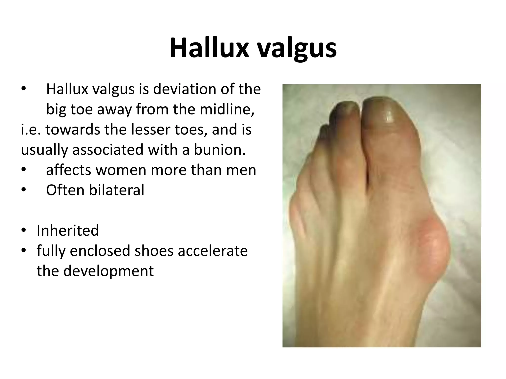 Lower limb deformities.pptx