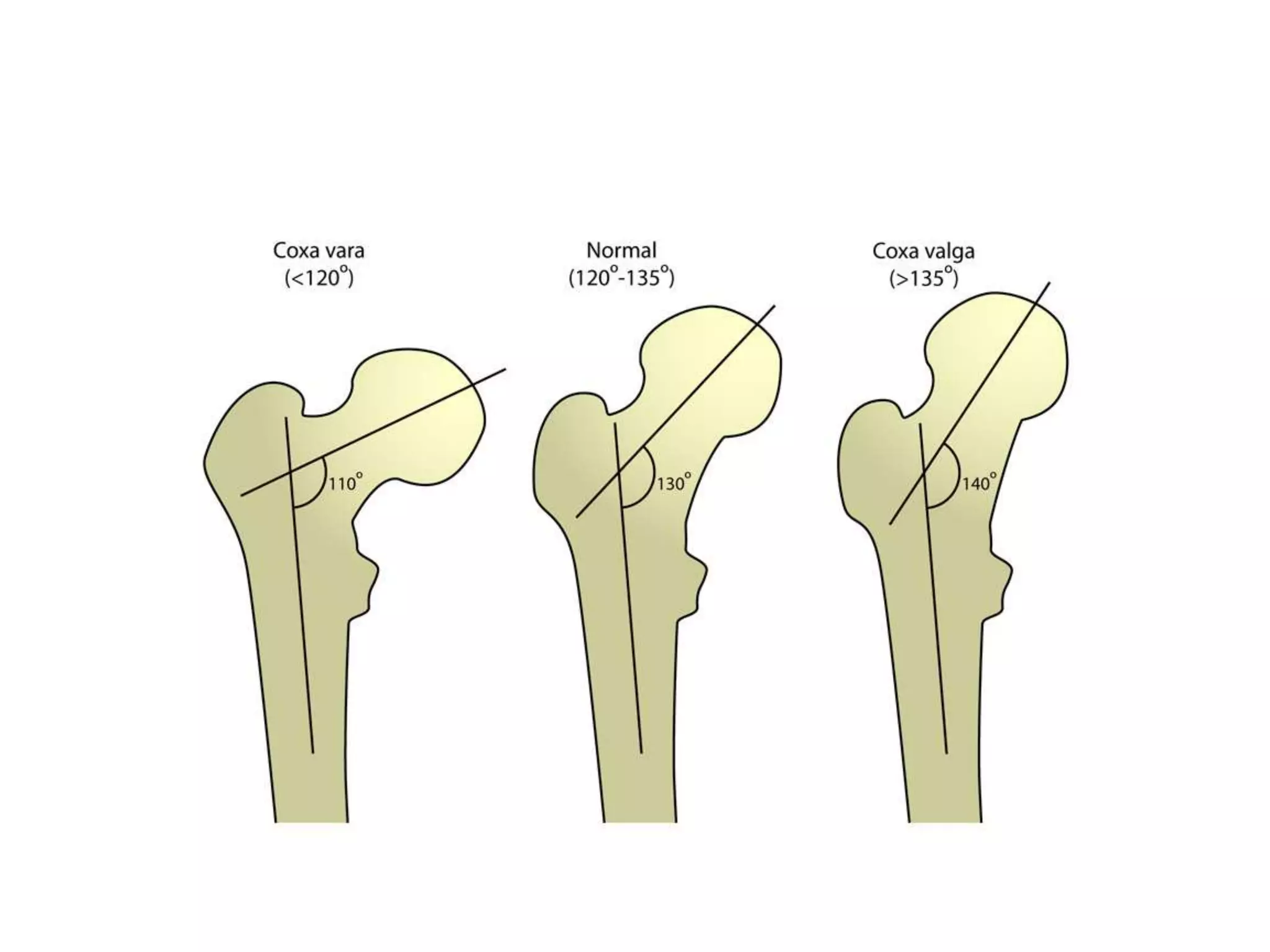 Lower limb deformities.pptx