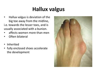 Lower limb deformities.pptx